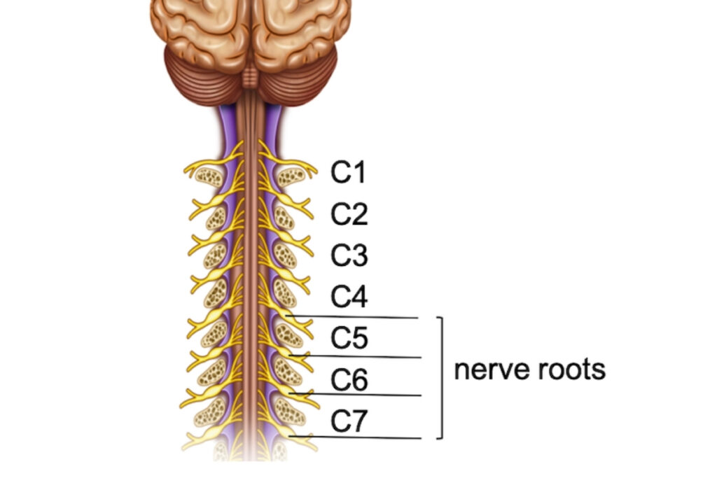 Cervical radiculopathy - Lex Medicus Publishing - Educational resource