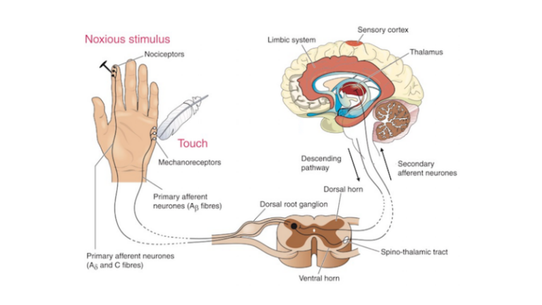 Dr Peter Blombery on chronic pain and pain measurement